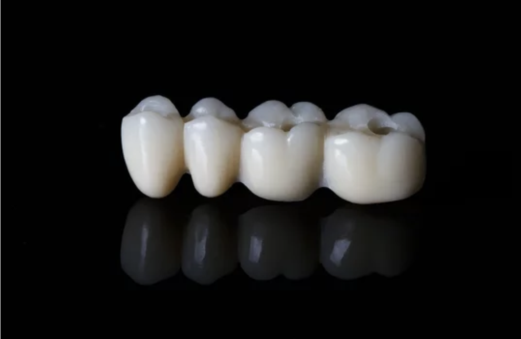 PMMA - Future Dental Studio