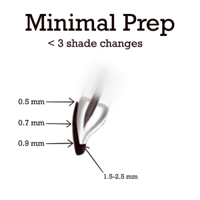 Veneer Prep Design: Comprehensive Guide for Dentists